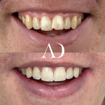 Adore Dental - Adore Your Smile