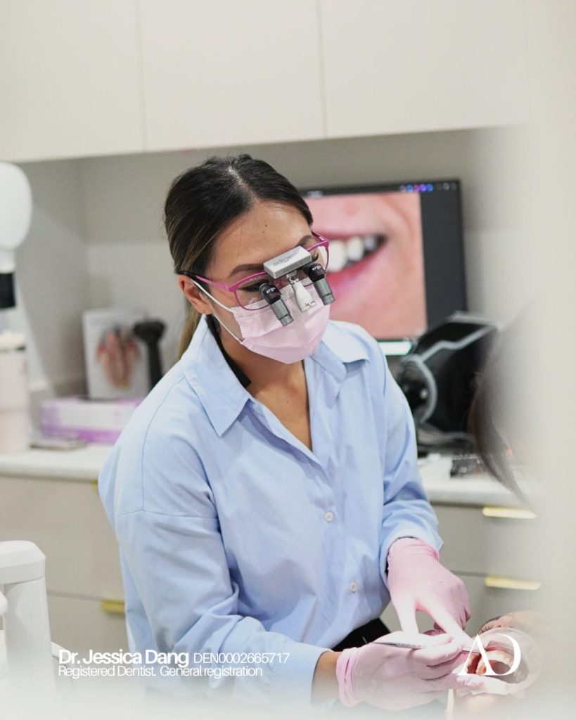 Veneers – Adore Dental